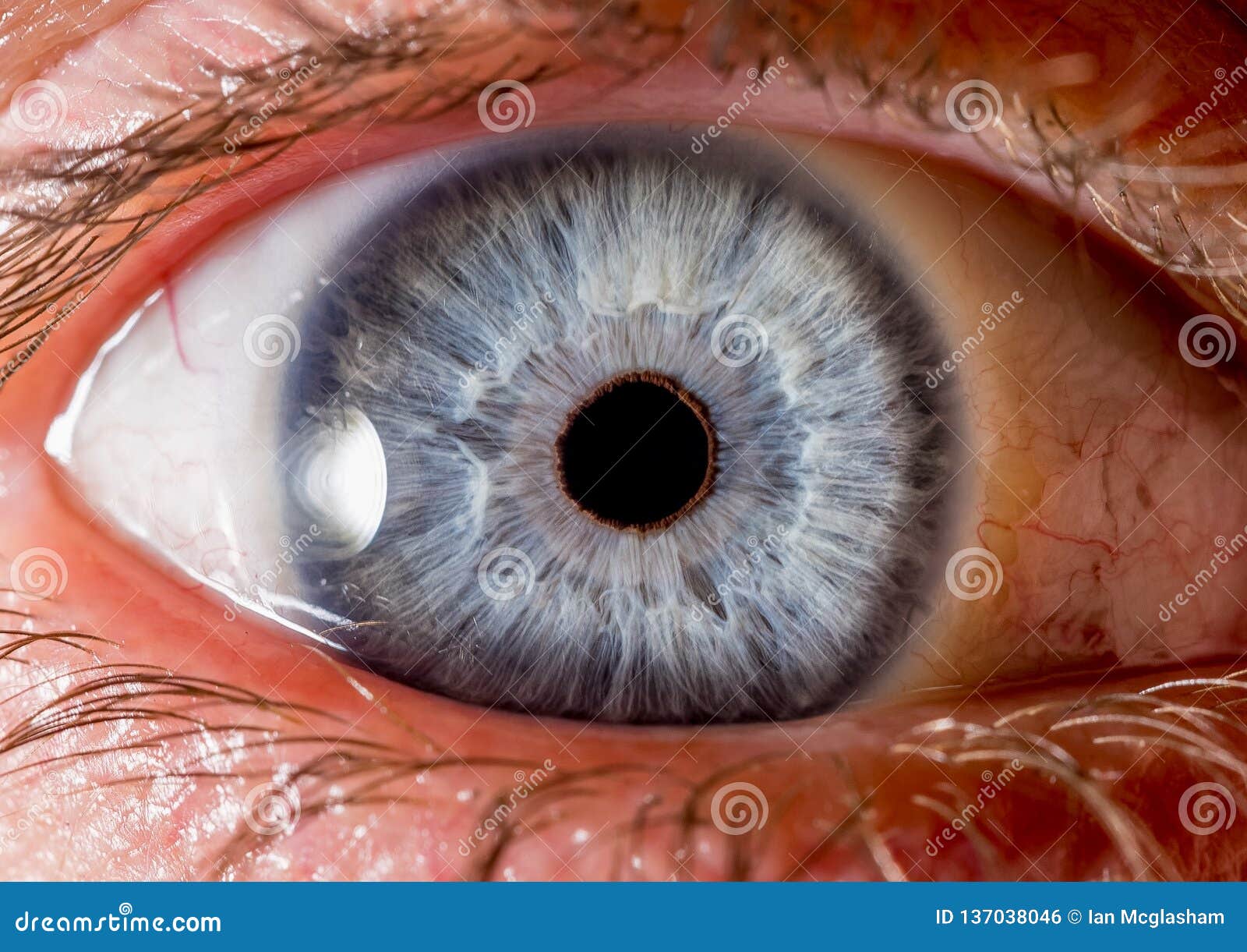 Close Up Eye. Close Up Iris. Very Close Macro Shot of an Eyeball Stock ...