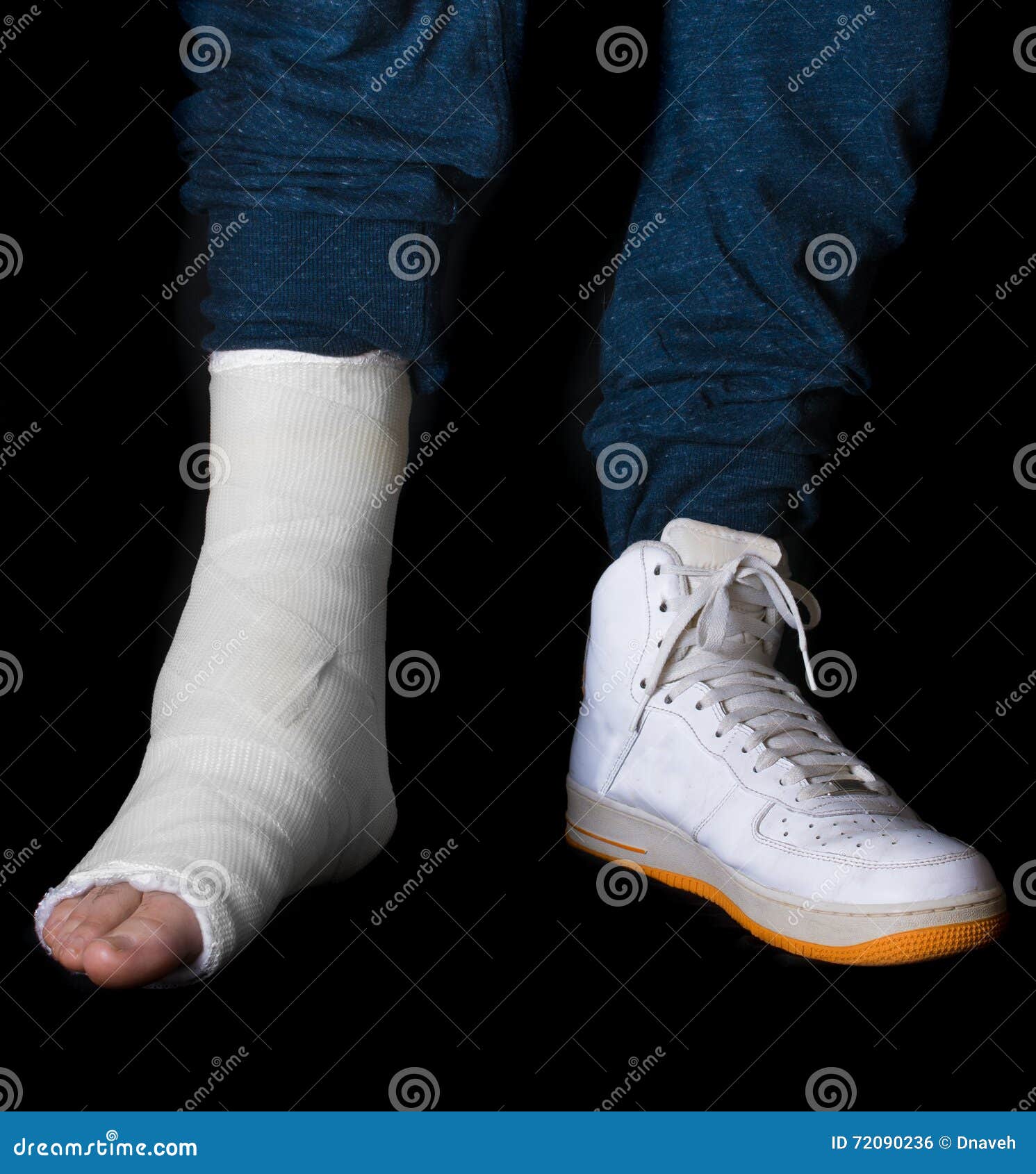 Giovane Con Una Caviglia Rotta E Una Colata Della Gamba Fotografia ...