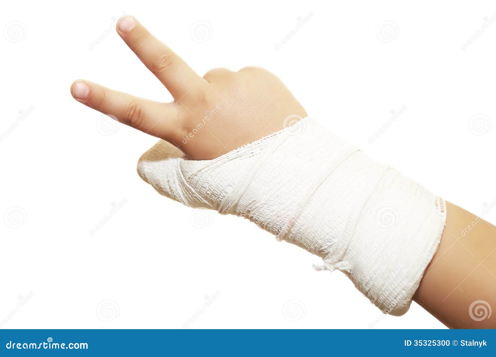 Gipsarm stock photo. Image of hurt, broken, human, hand - 35325300