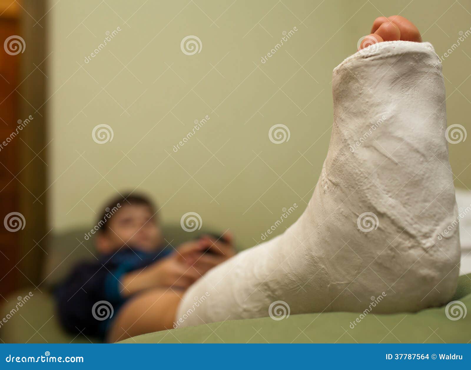 Gipsbein stockfoto. Bild von verband, geschnitzt, medizinisch - 37787564