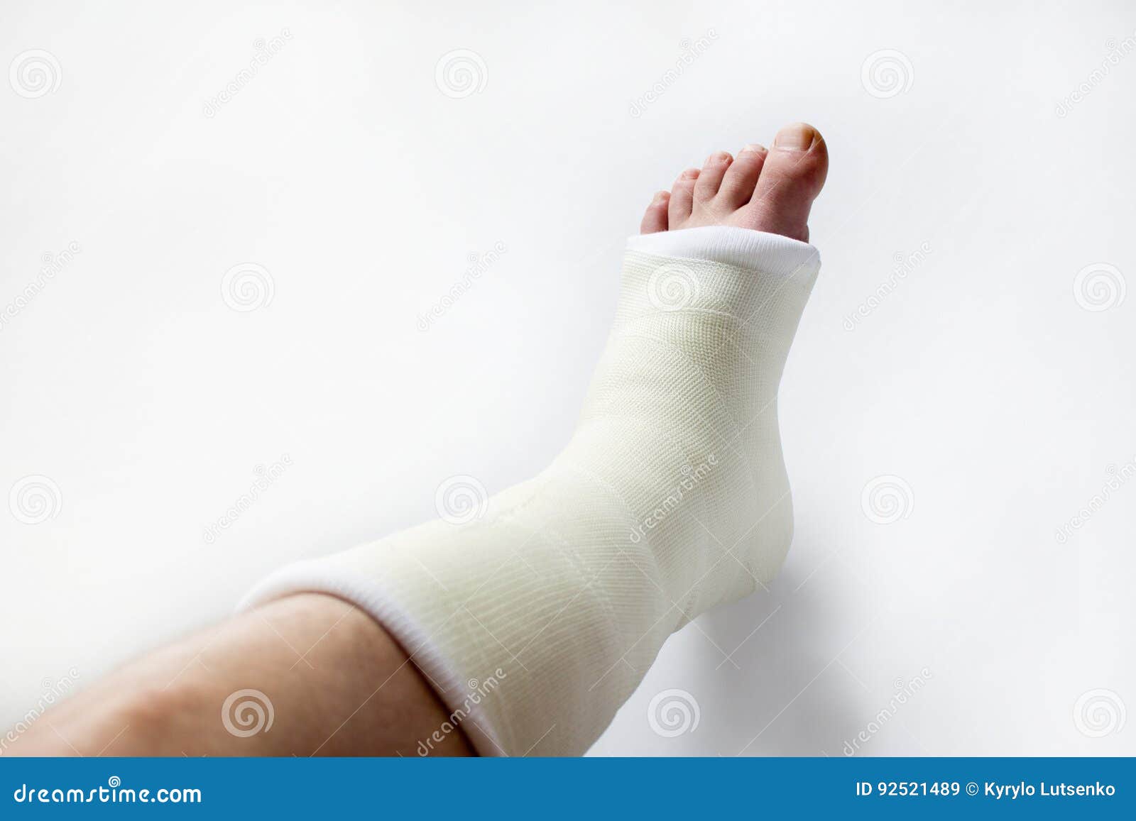 Gipsbein stockbild. Bild von medikation, unfall, doktor - 92521489