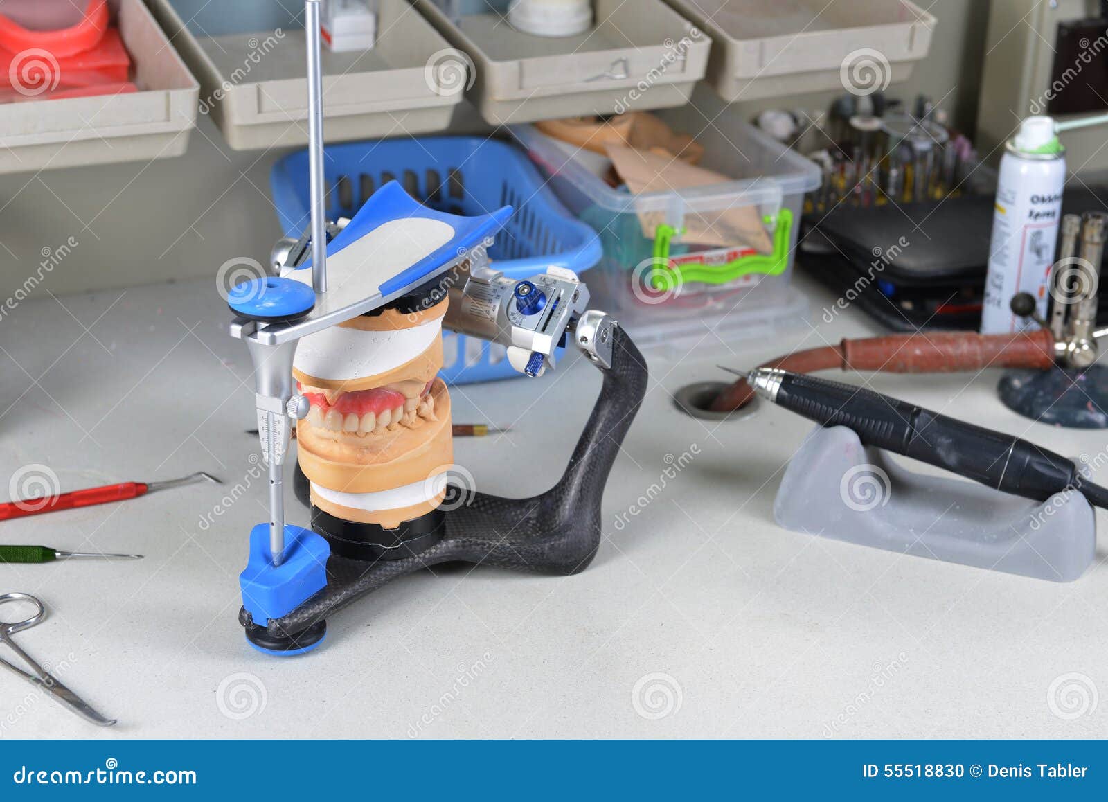 Gipsmodel van kaak stock foto. Image of prothese, schommeling - 55518830