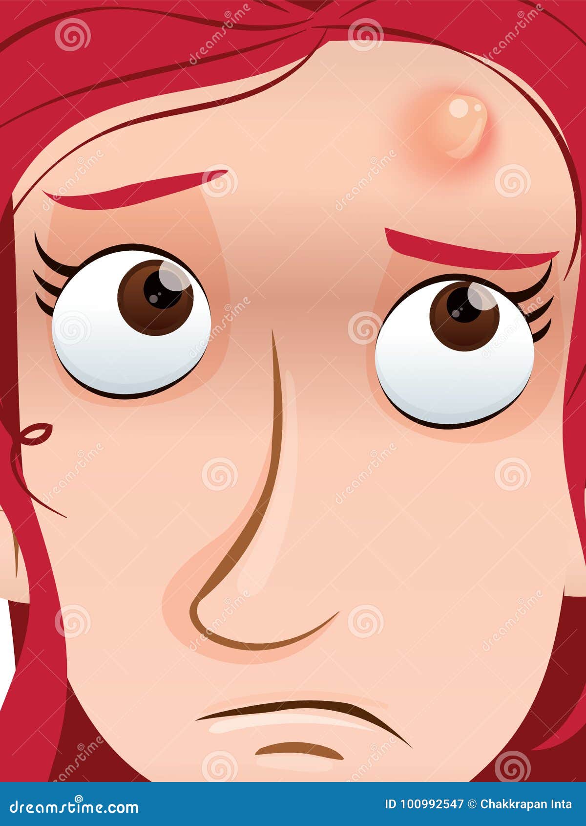 Girl with Big Pimples on Forehead Stock Vector - Illustration of acne ... Girl with Big Pimples on Forehead Stock Vector - Illustration of acne ...