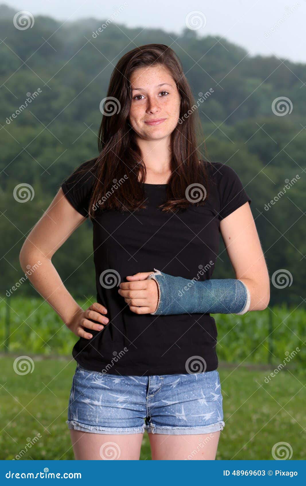 Girl broken arm stock image. Image of brunette, young - 48969603