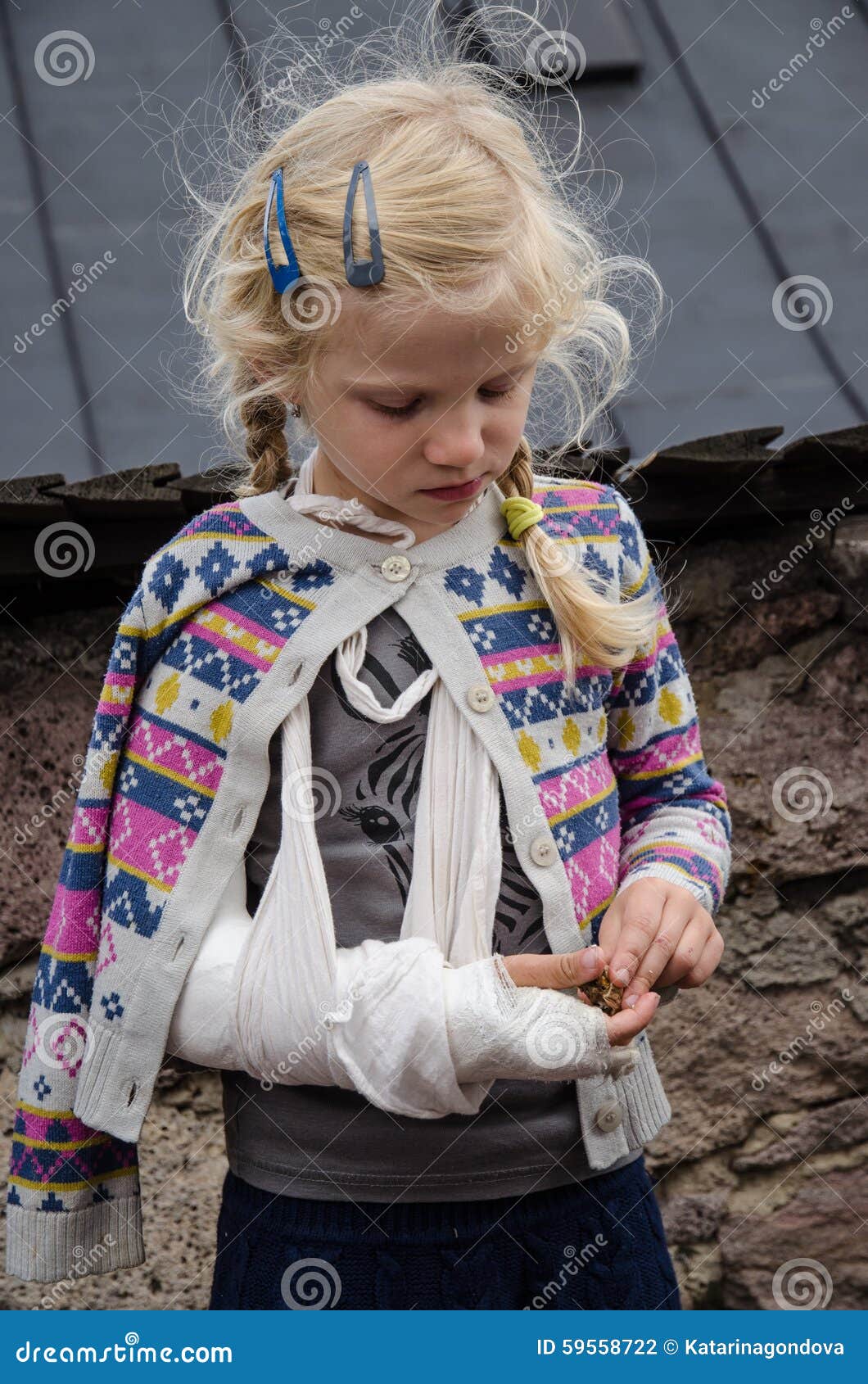 Girl with broken hand stock photo. Image of blond, girl - 59558722