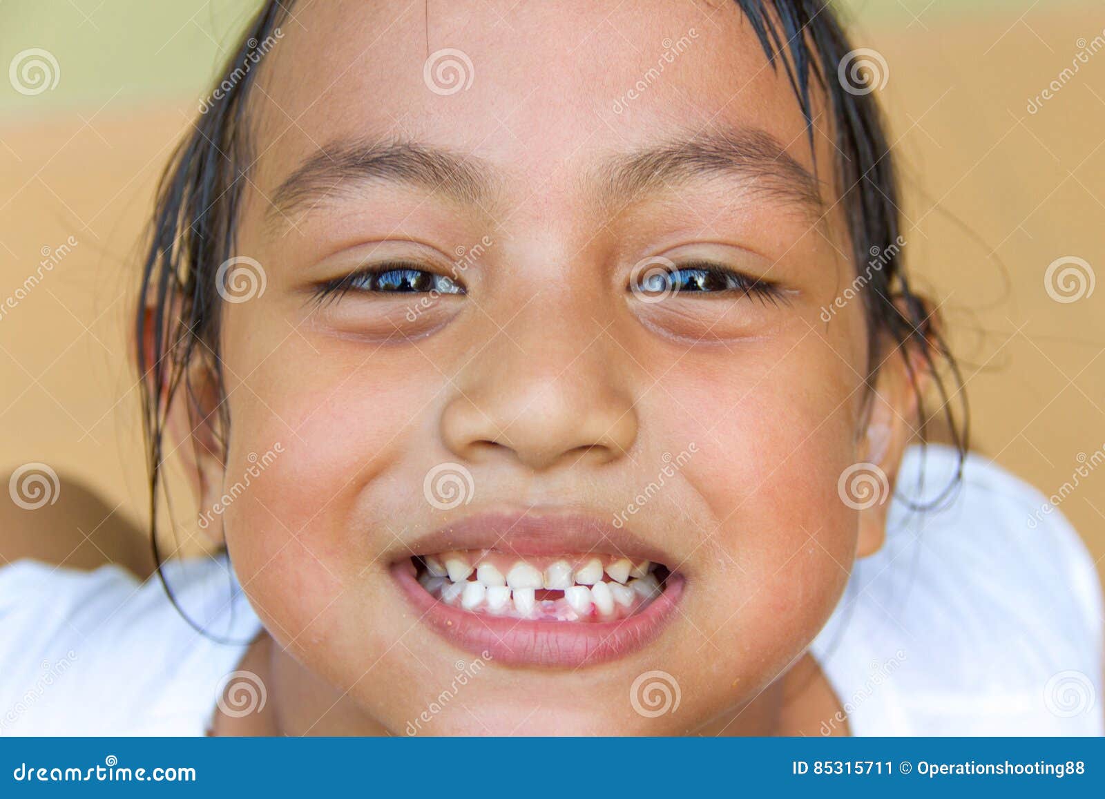 Girl broken tooth stock image. Image of closeup, asian - 85315711