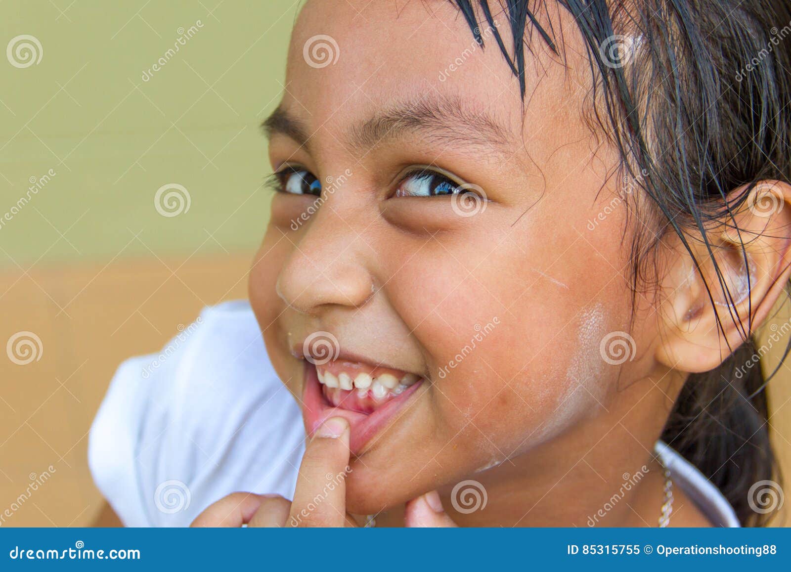 Girl broken tooth stock image. Image of lost, beauty - 85315755