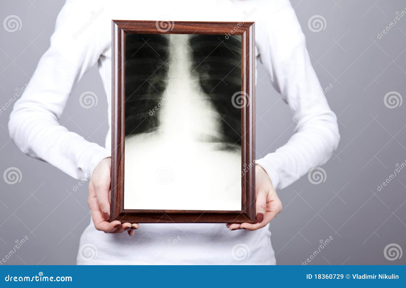 178 X Ray Frame Stock Photos - Free & Royalty-Free Stock Photos from ...