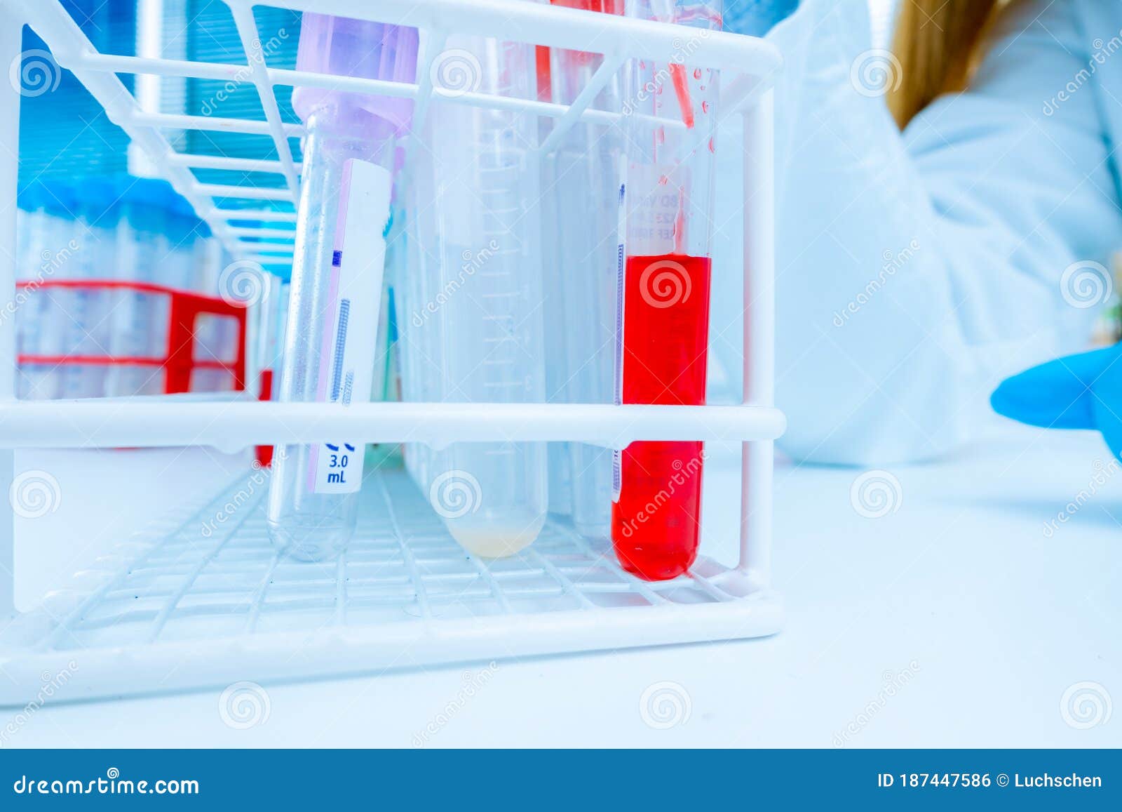 Girl Lab Technician at the Clinic`s Microbiology Laboratory Stock Photo ...