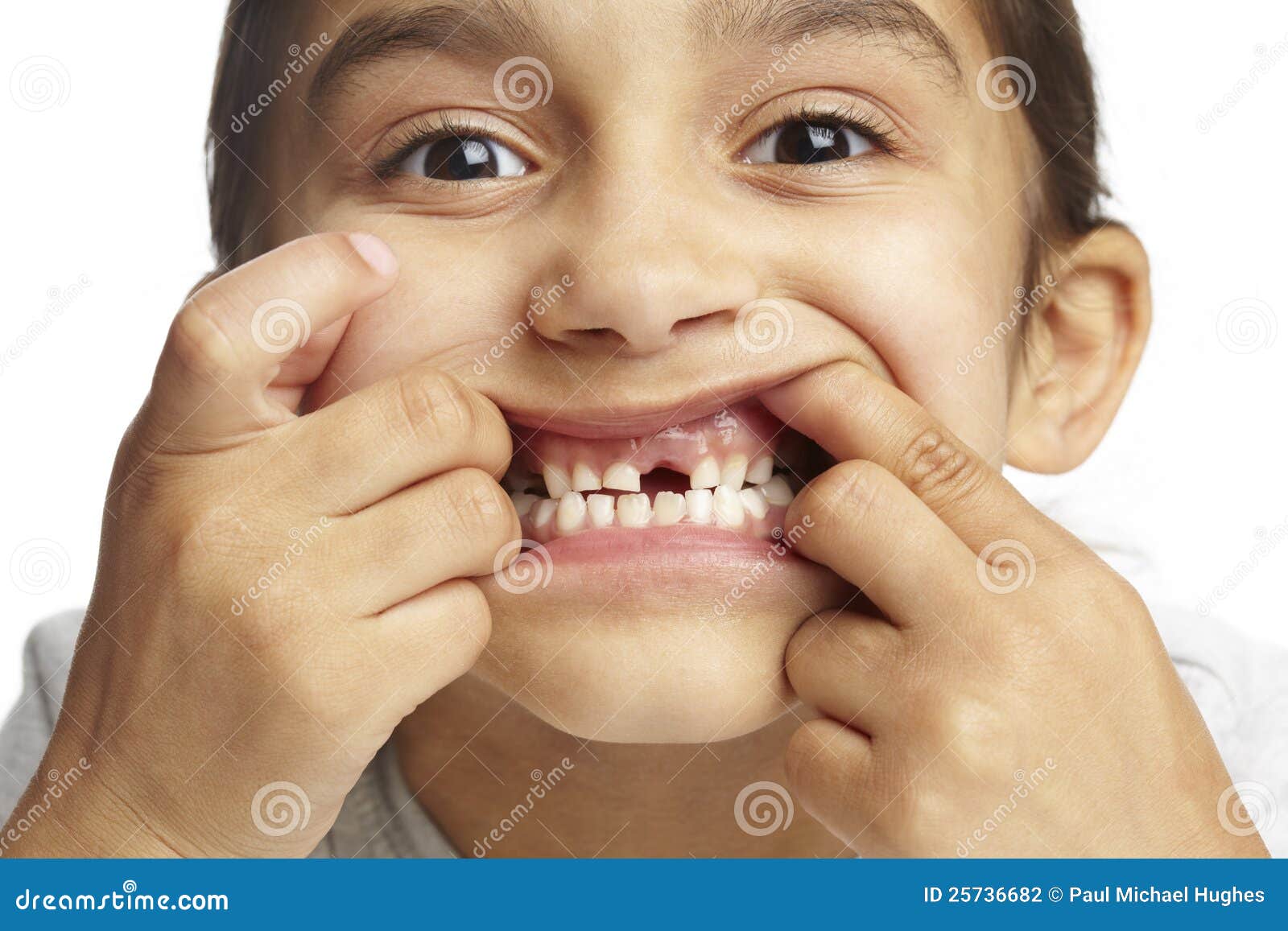 Girl with Missing Front Tooth Stock Photo - Image of happy, person ...