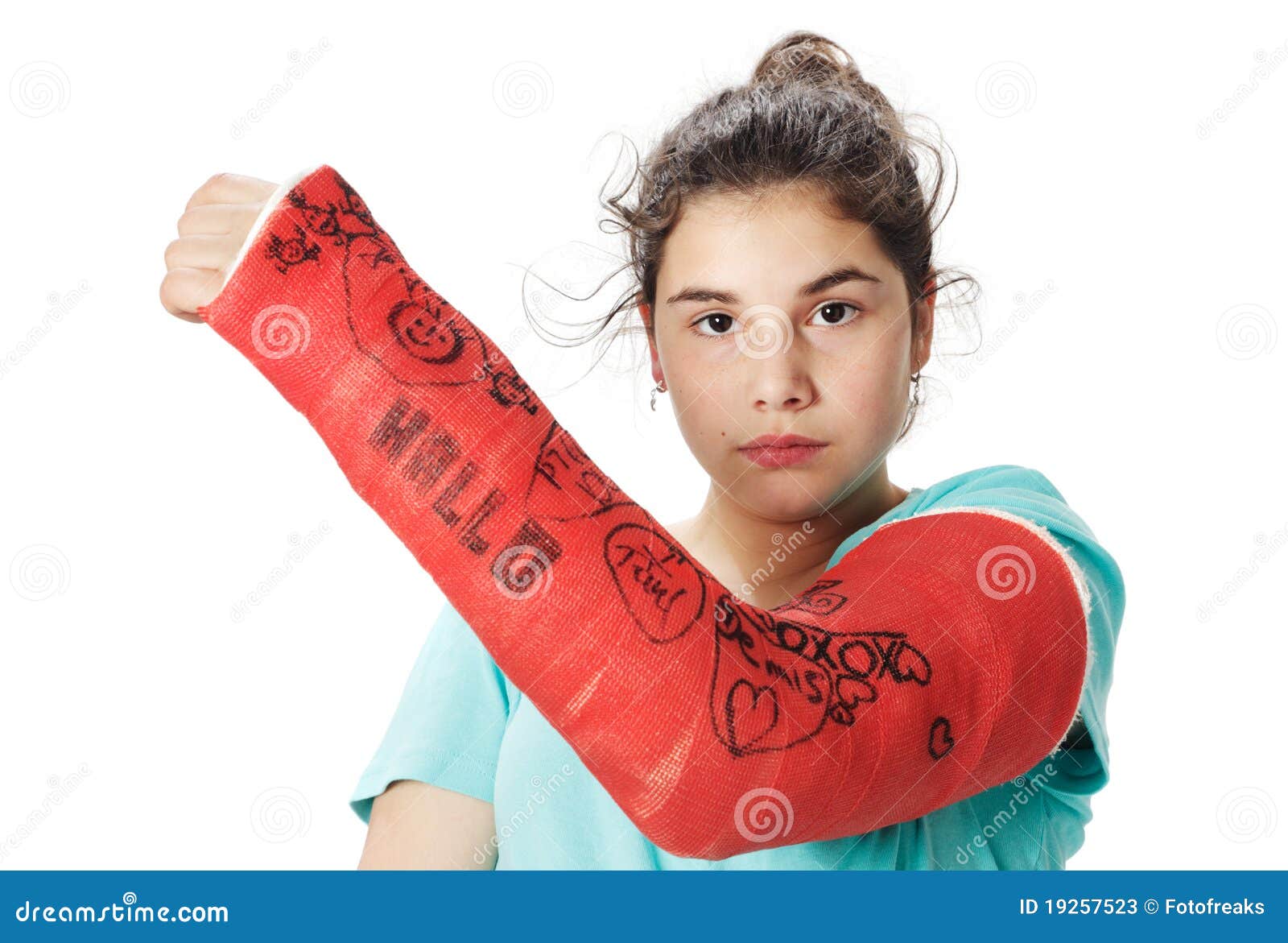 Girl with plaster bandage stock image. Image of hurt - 19257523