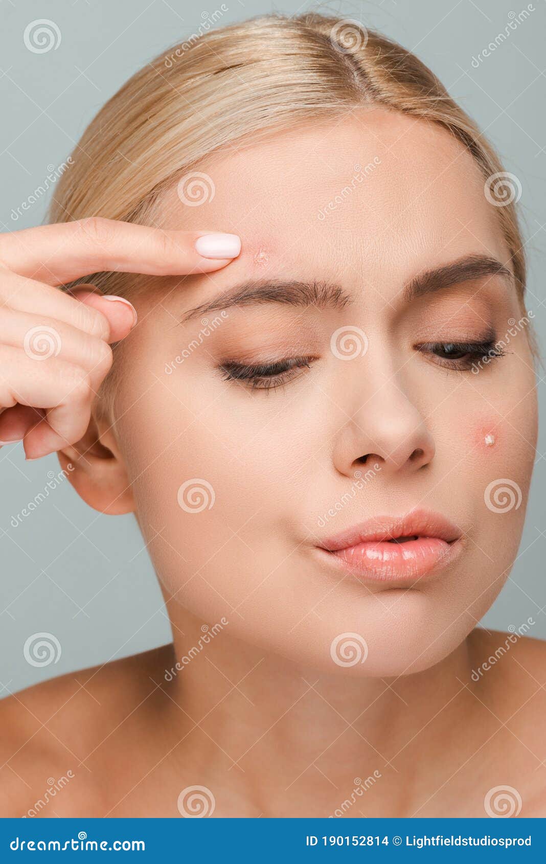Girl Pointing with Finger at Face with Acne on Grey Stock Photo - Image ...