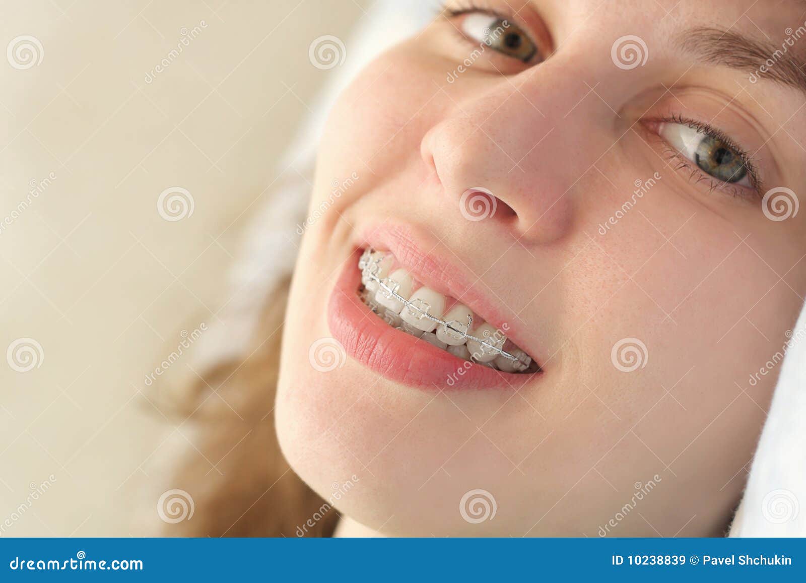 Girl smiles with braces stock image. Image of medicine - 10238839