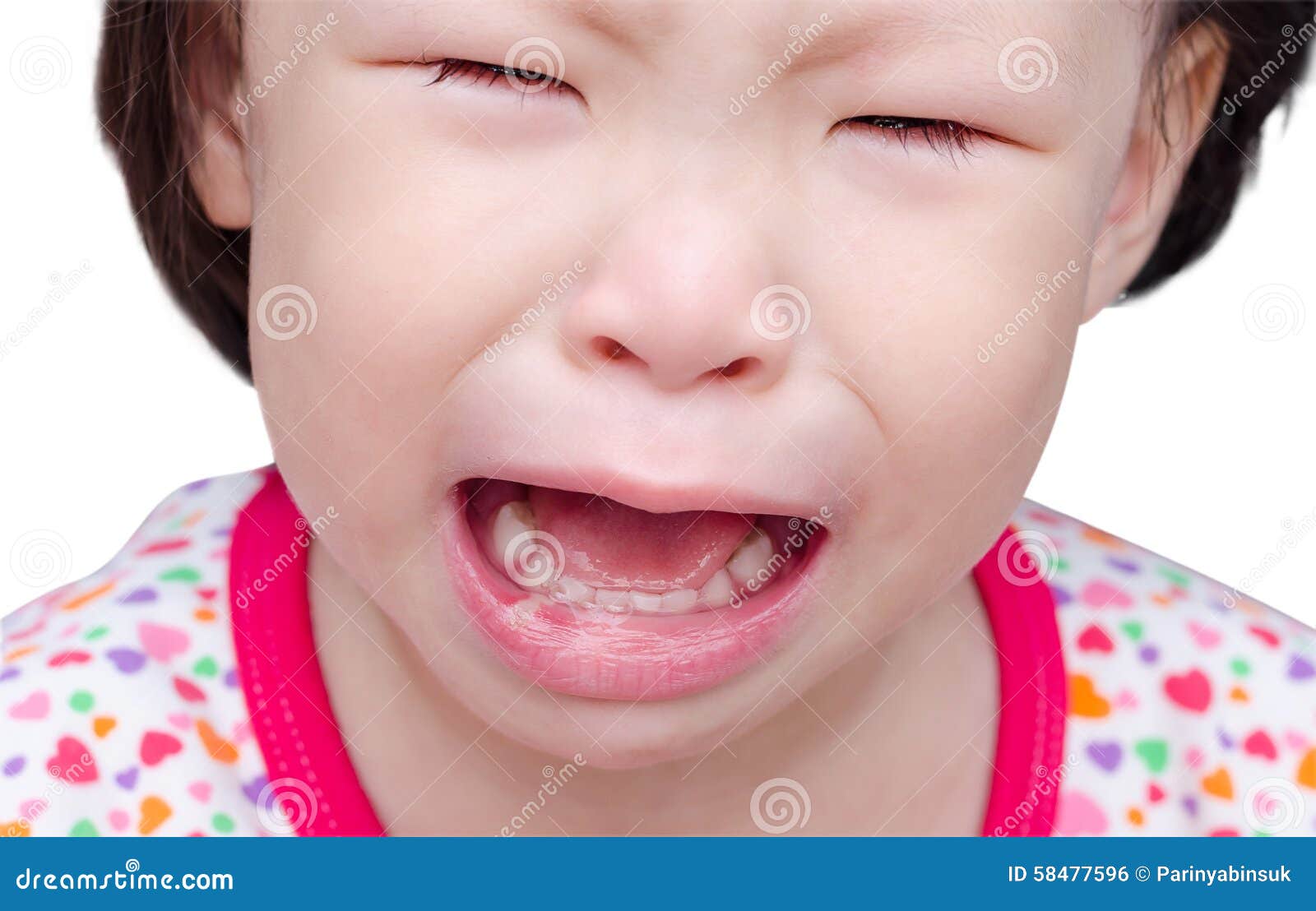 Girl with sore mouth stock photo. Image of canker, closeup - 58477596