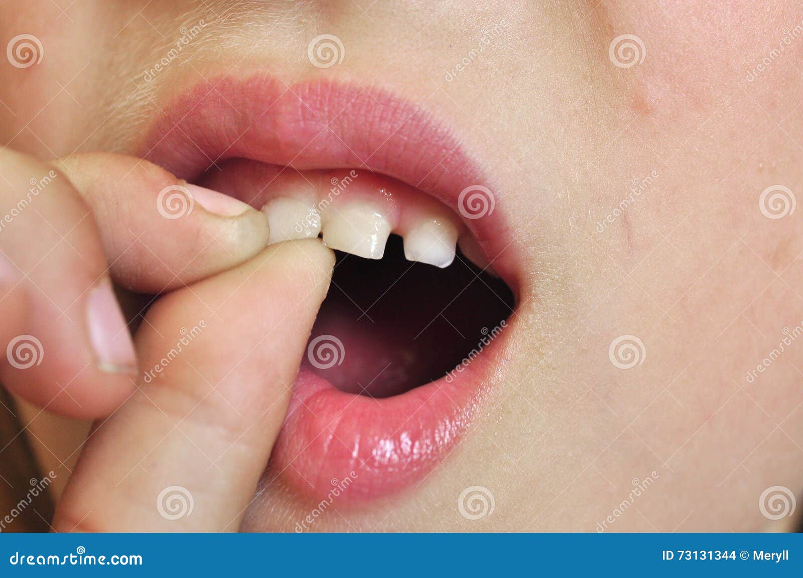 Giro excéntrico del diente foto de archivo. Imagen de salud - 73131344