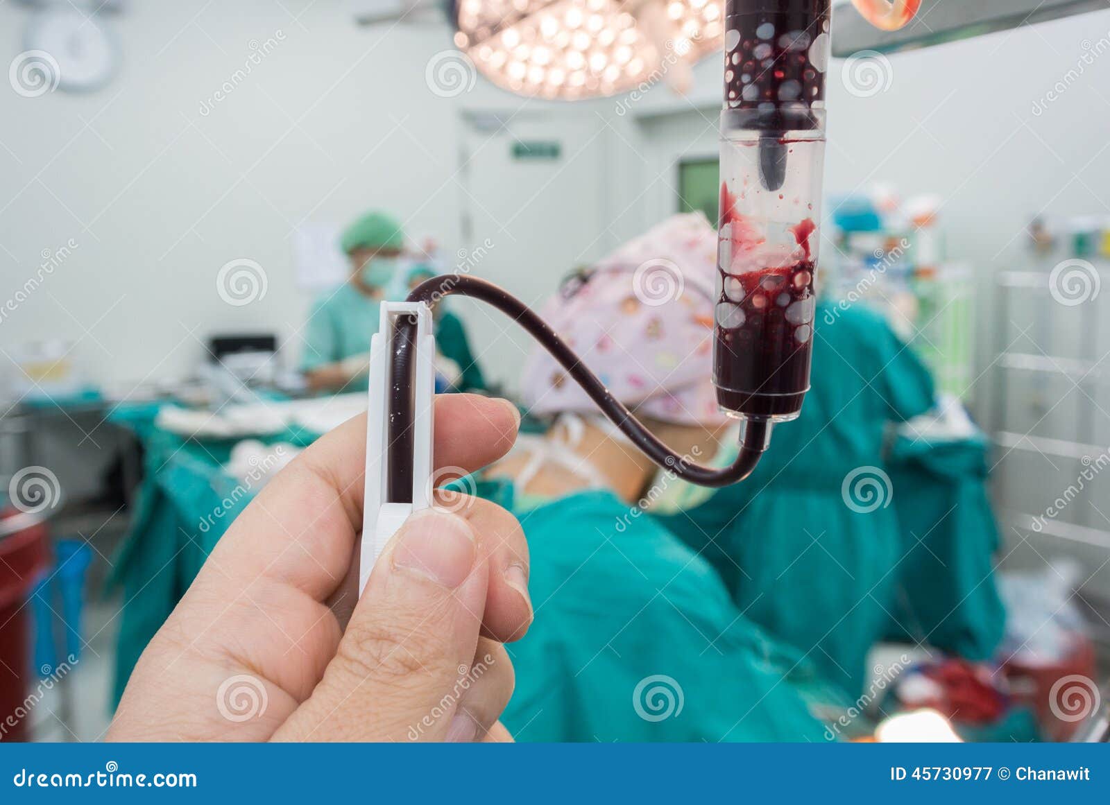 Giving Packed Red Cell during Open Heart Surgery Stock Image - Image of ...