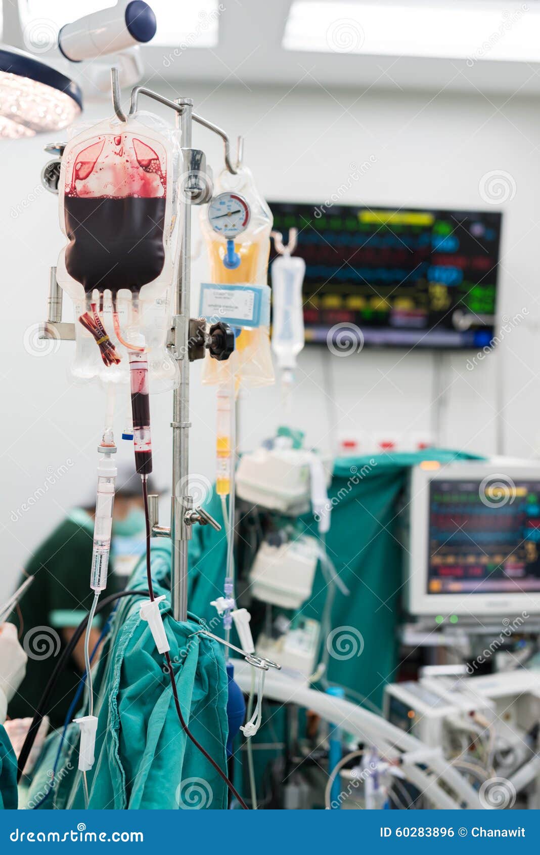 Giving Packed Red Cell during Surgery Stock Photo - Image of operation ...