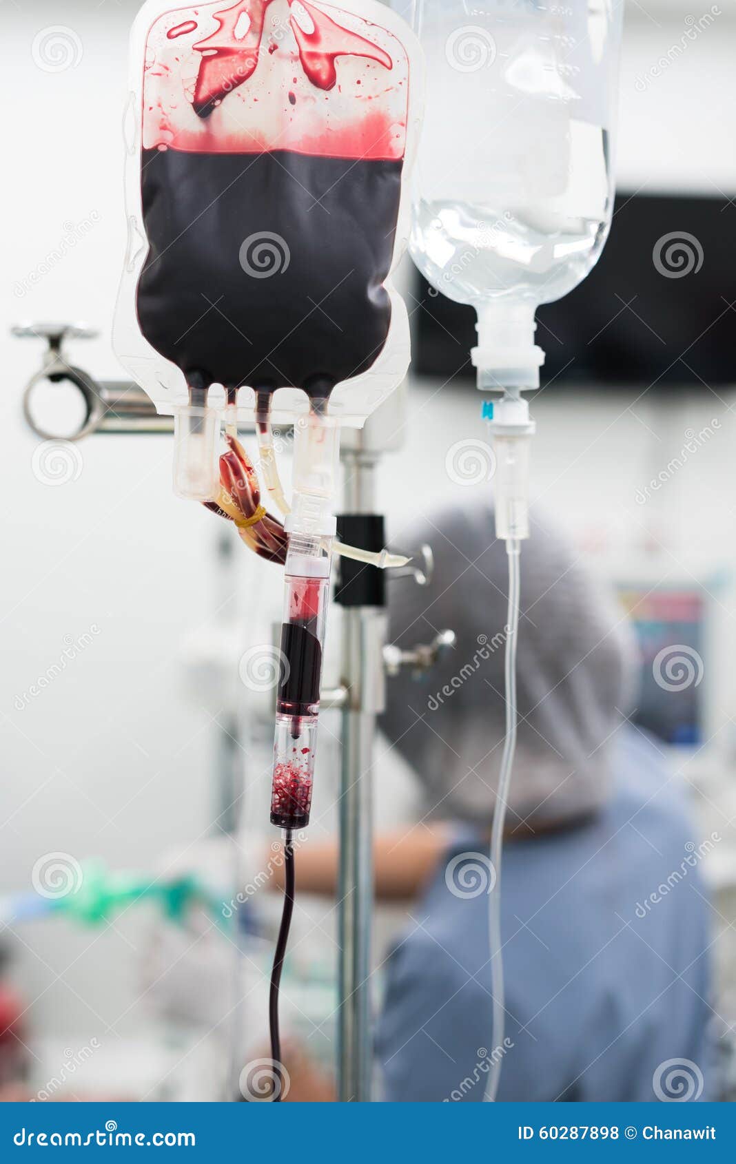Giving Packed Red Cell during Surgery Stock Photo - Image of emergency ...