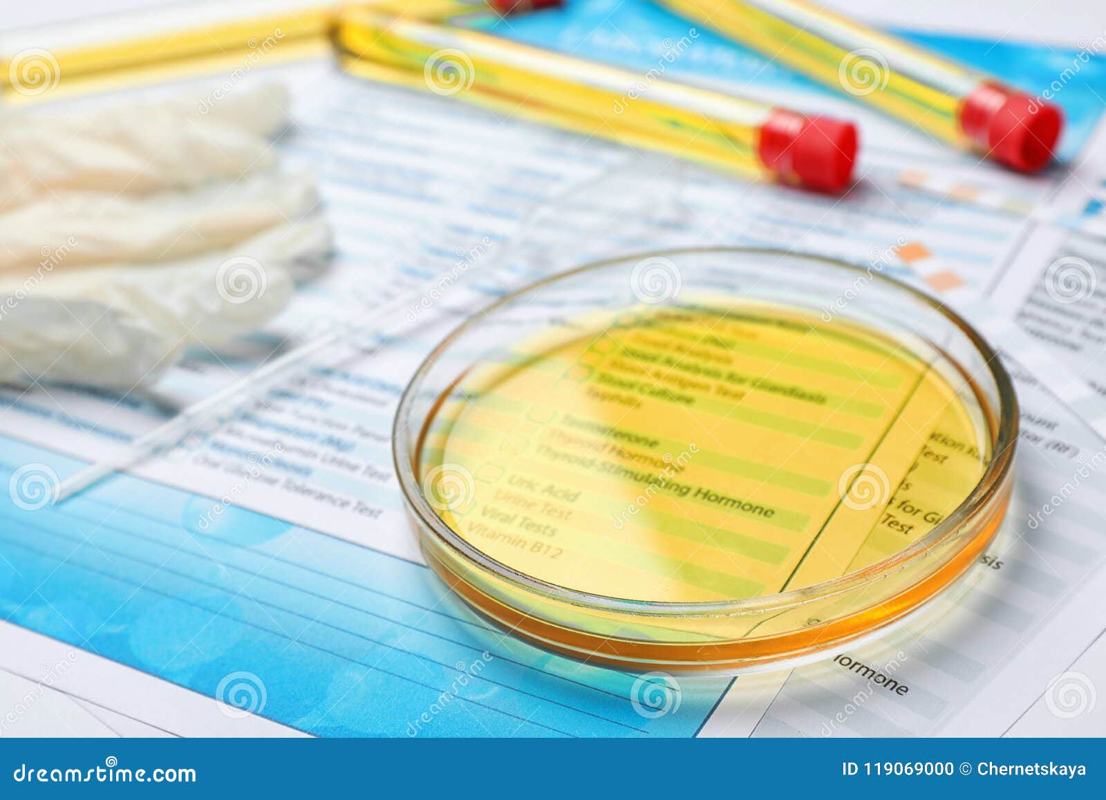 Glass Dish with Urine Sample and Test Forms Stock Photo - Image of ...