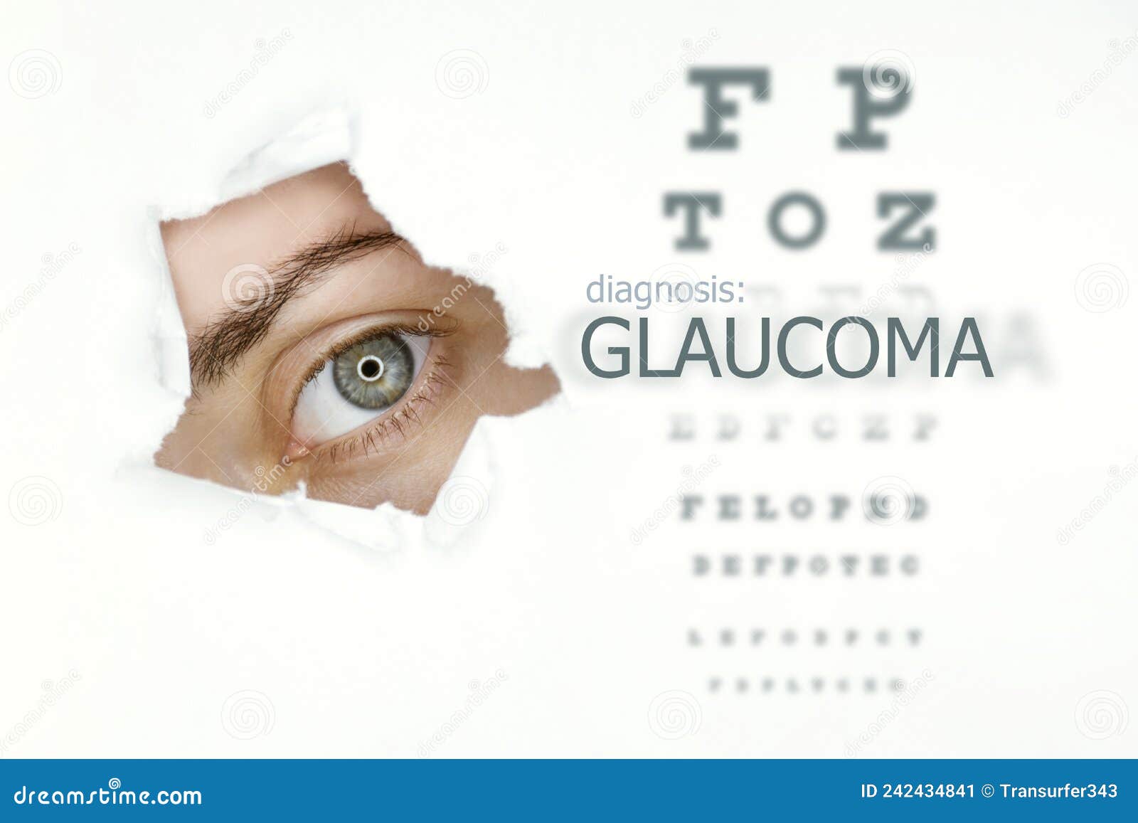 Glaucoma Disease Poster with Eye Test and Blue Eye on Left. Stock ...
