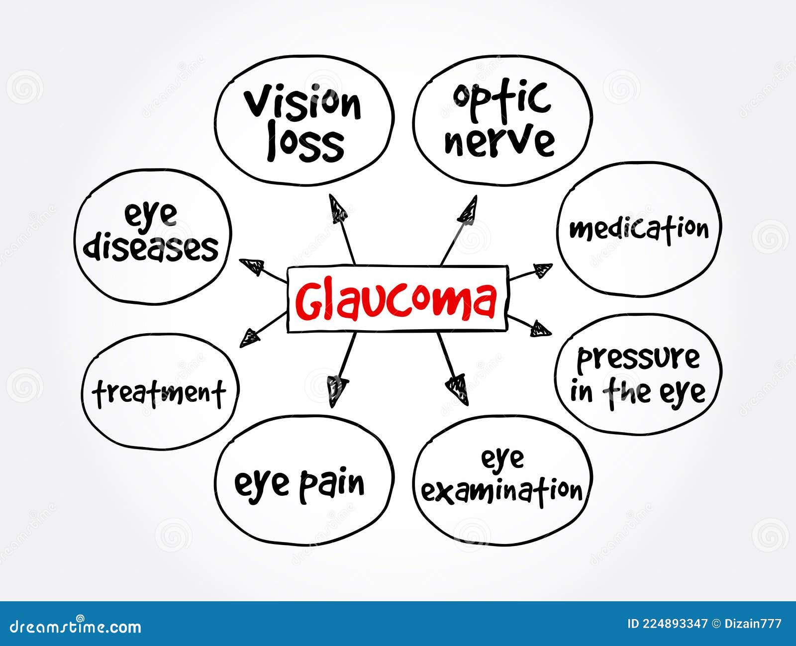 Glaucoma Mind Map, Medical Concept for Presentations and Reports Stock ...
