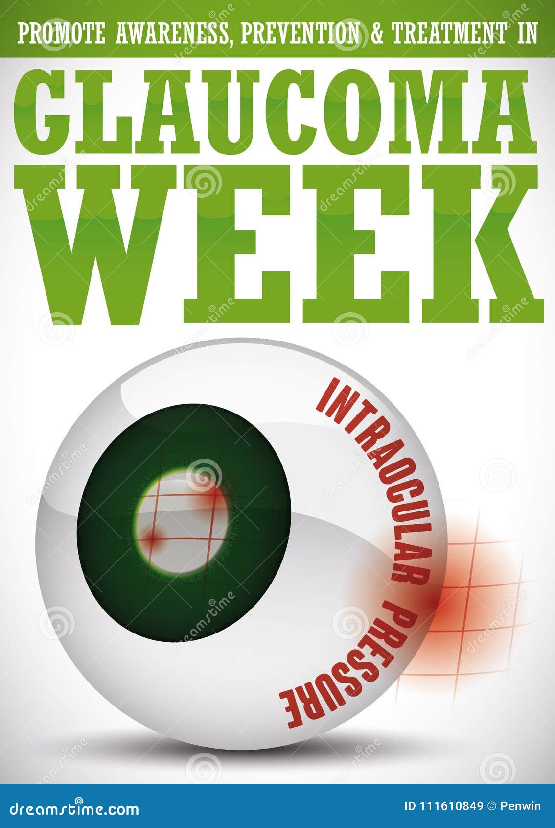 Glaucoma. Aqueous Humour Fluid Exits And Flow To Canal Of Schlemm Human ...