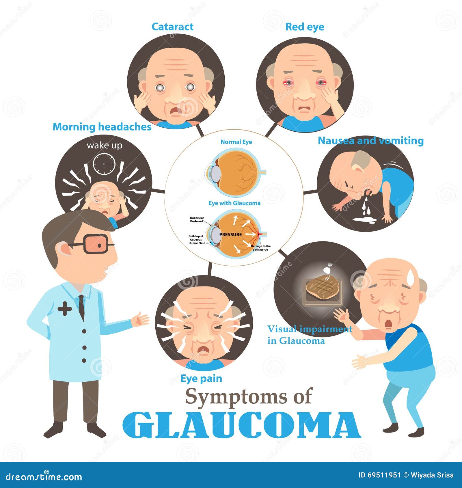 Glaucome Stock Illustrations, Vecteurs, & Clipart – (999 Stock ...
