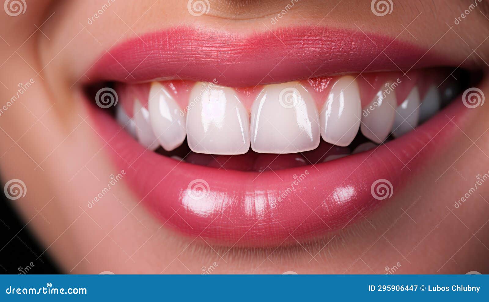 Gleaming White Teeth with Perfect Implants Stock Illustration ...
