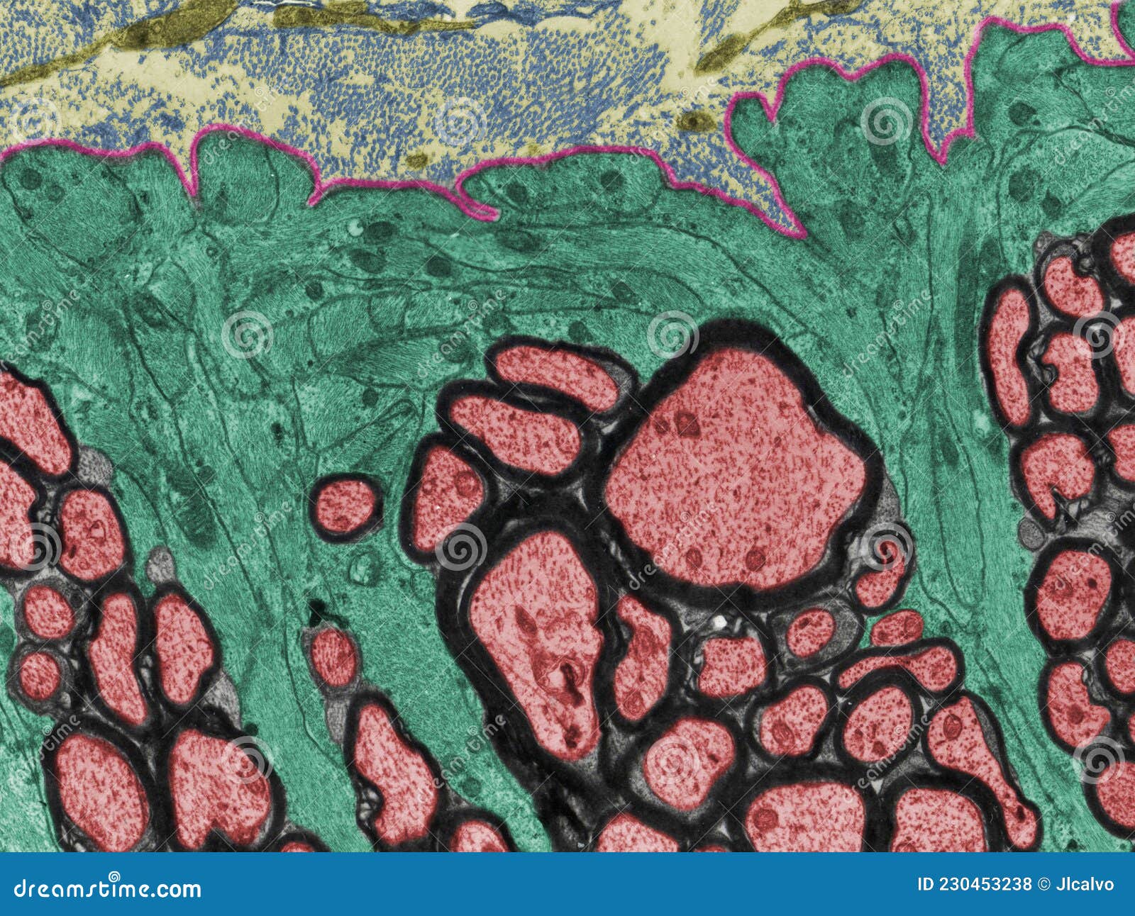 Glial limiting membrane stock photo. Image of false - 230453238