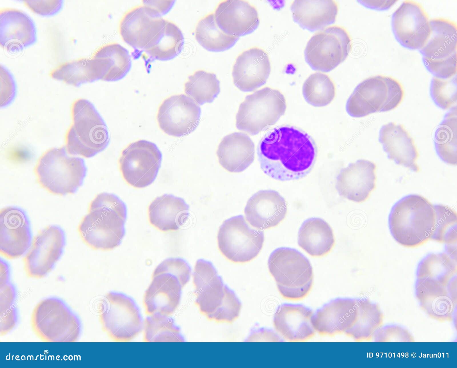 Globule blanc photo stock. Image du leucocyte, lymphocytes - 97101498