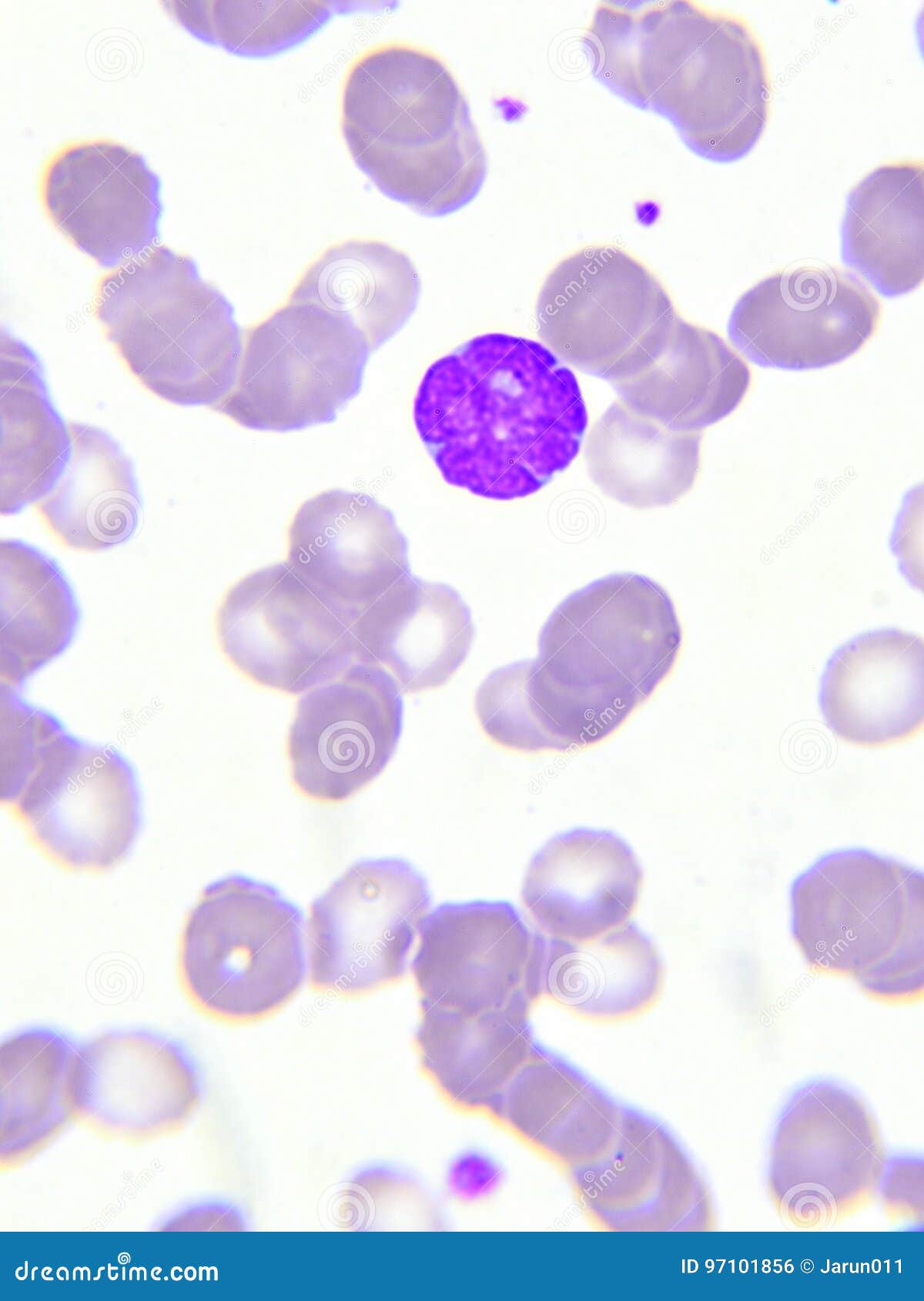 Globule blanc photo stock. Image du laboratoire, anormal - 97101856