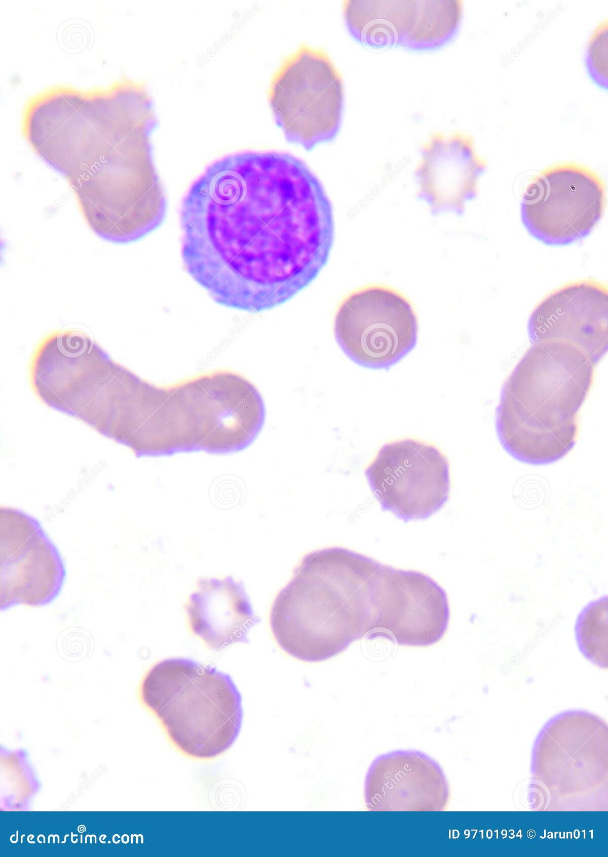 Globule blanc photo stock. Image of anémie, soin, inspection - 97101934