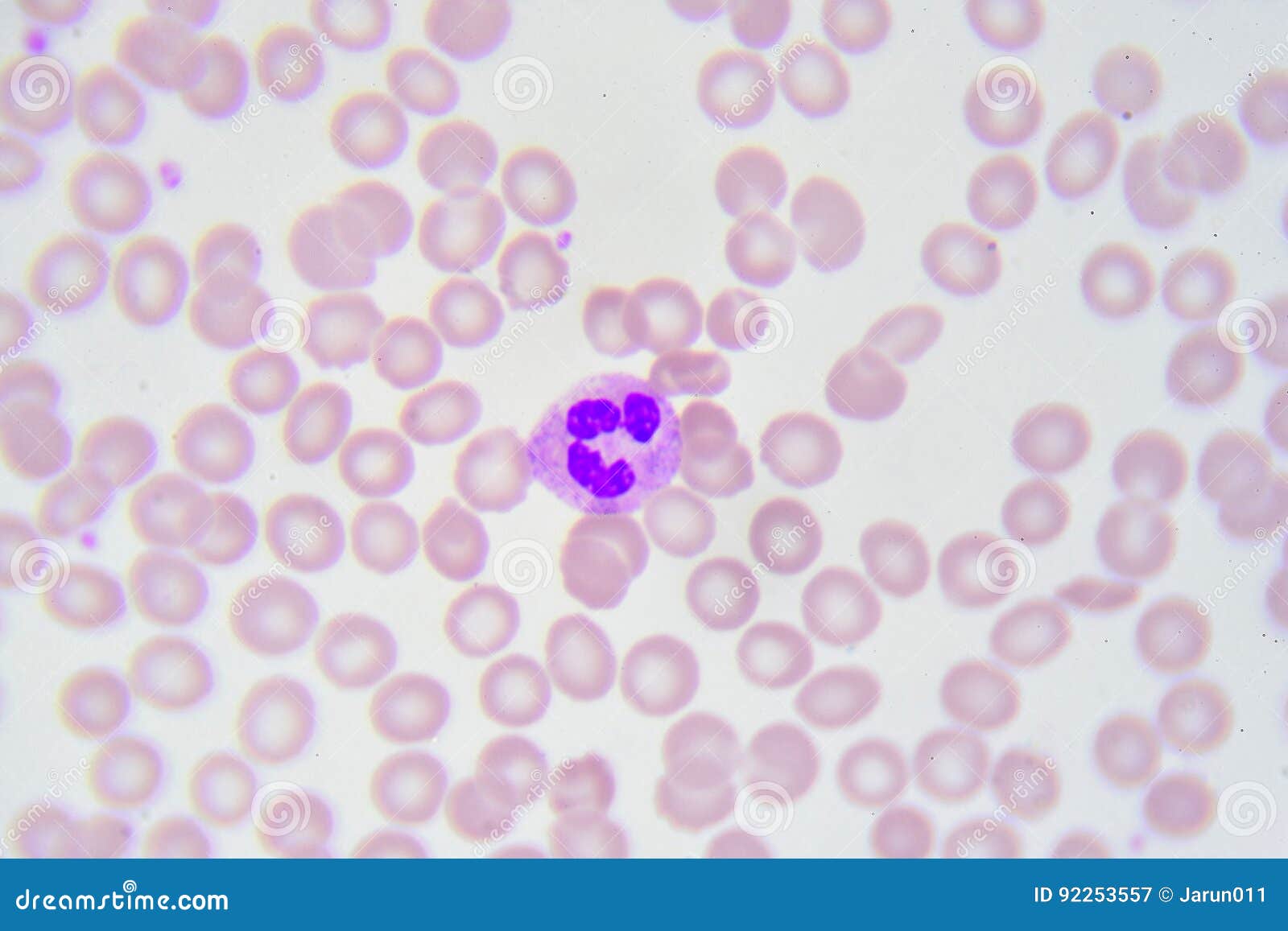 Globules blancs normaux image stock. Image of laboratoire - 92253557