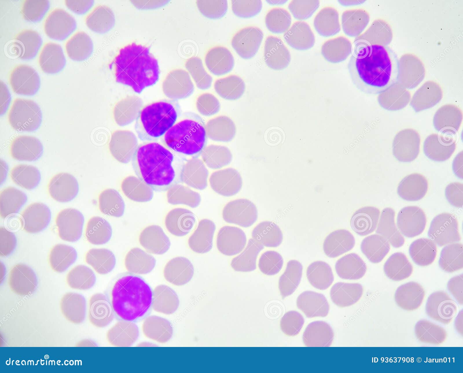 Globules blancs normaux photo stock. Image du contrôle - 93637908