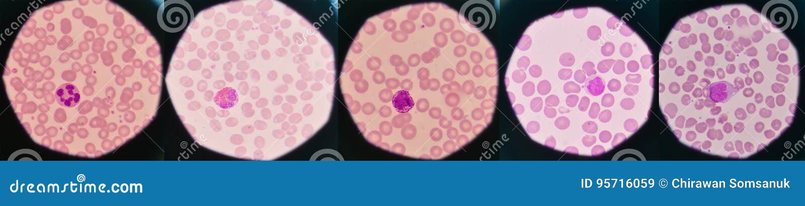 Globules Blancs Sur Le Fond De Globules Rouges Image stock - Image du ...