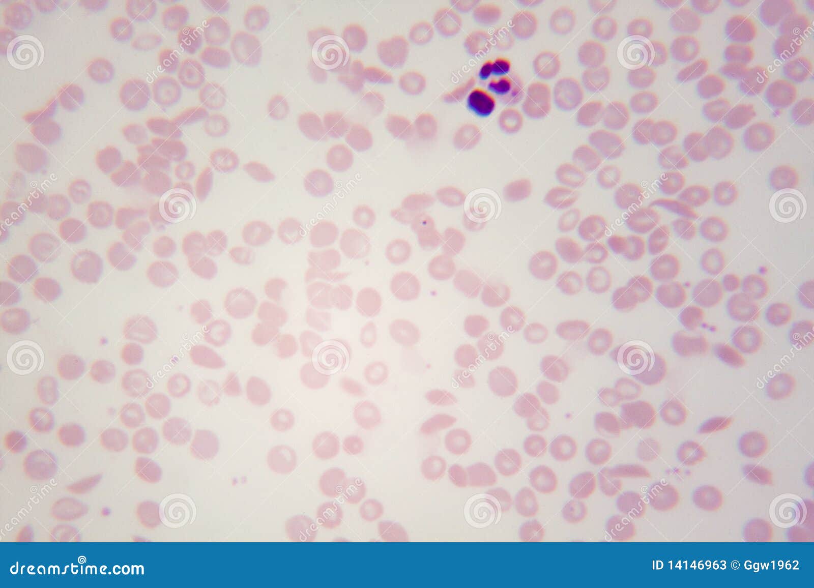 Globules rouges image stock. Image du médecine, clinique - 14146963