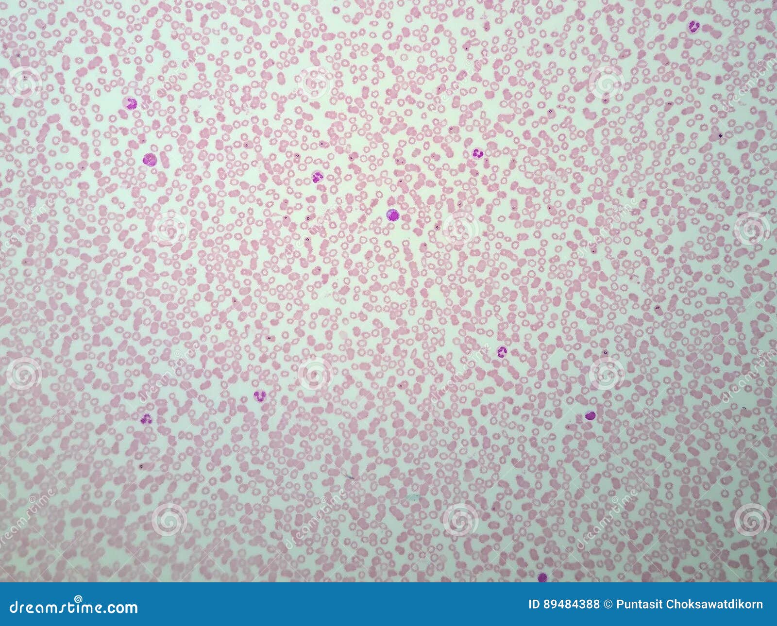 Globules sanguins humains photo stock. Image du médical - 89484388