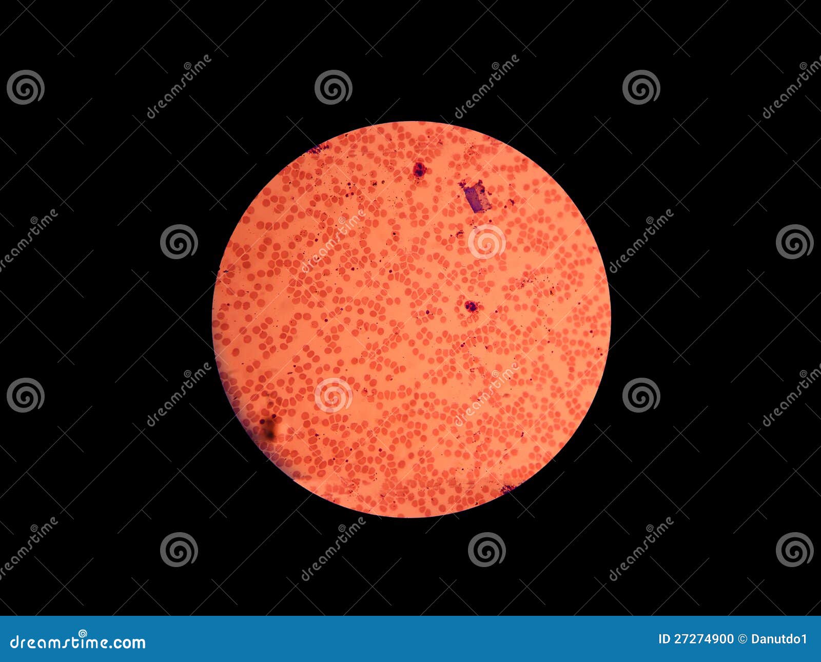 Globules Sanguins Sous Le Microscope Photo stock - Image du grand ...