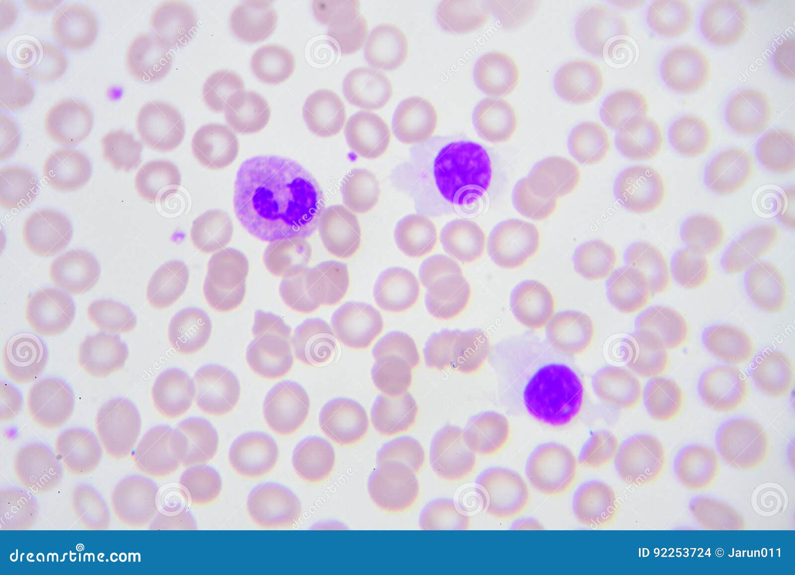 Globuli bianchi normali fotografia stock. Immagine di anima - 92253724