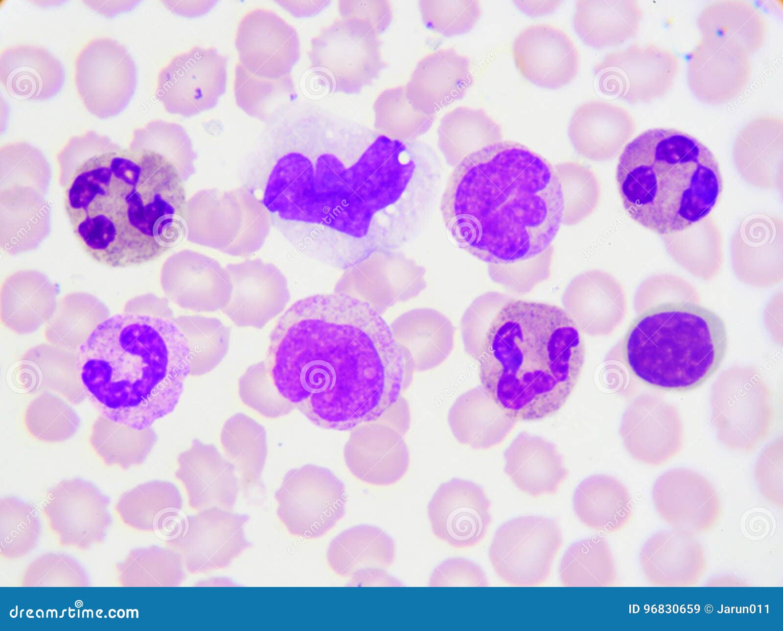 Globuli bianchi normali immagine stock. Immagine di microscopia - 96830659