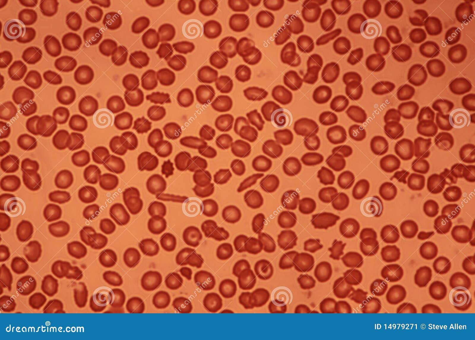 Globuli umani immagine stock. Immagine di circolazione - 14979271