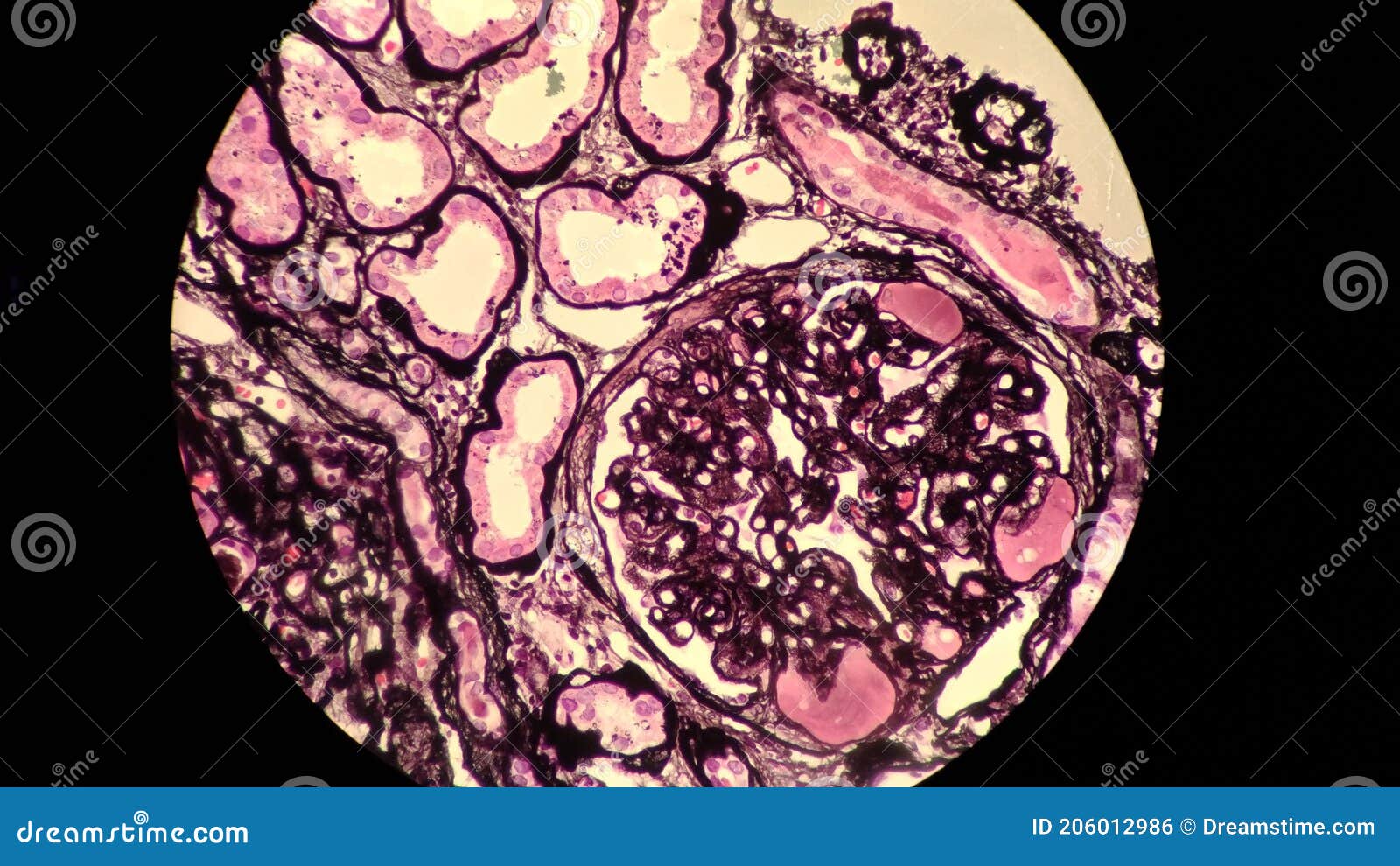 Glomerulus stock photo. Image of microscope, plant, petal - 206012986