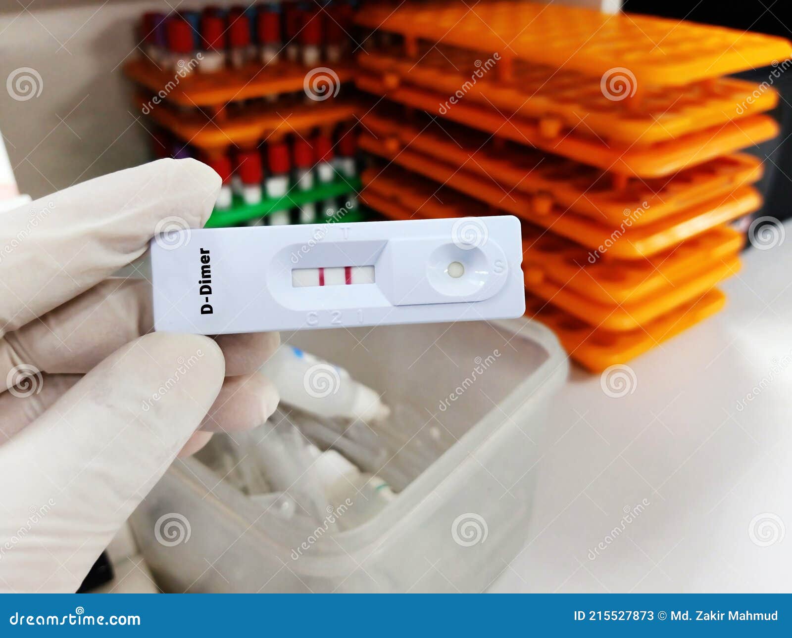 Device For D-Dimer Rapid Screening Test. Covid-19 Patient Monitoring ...
