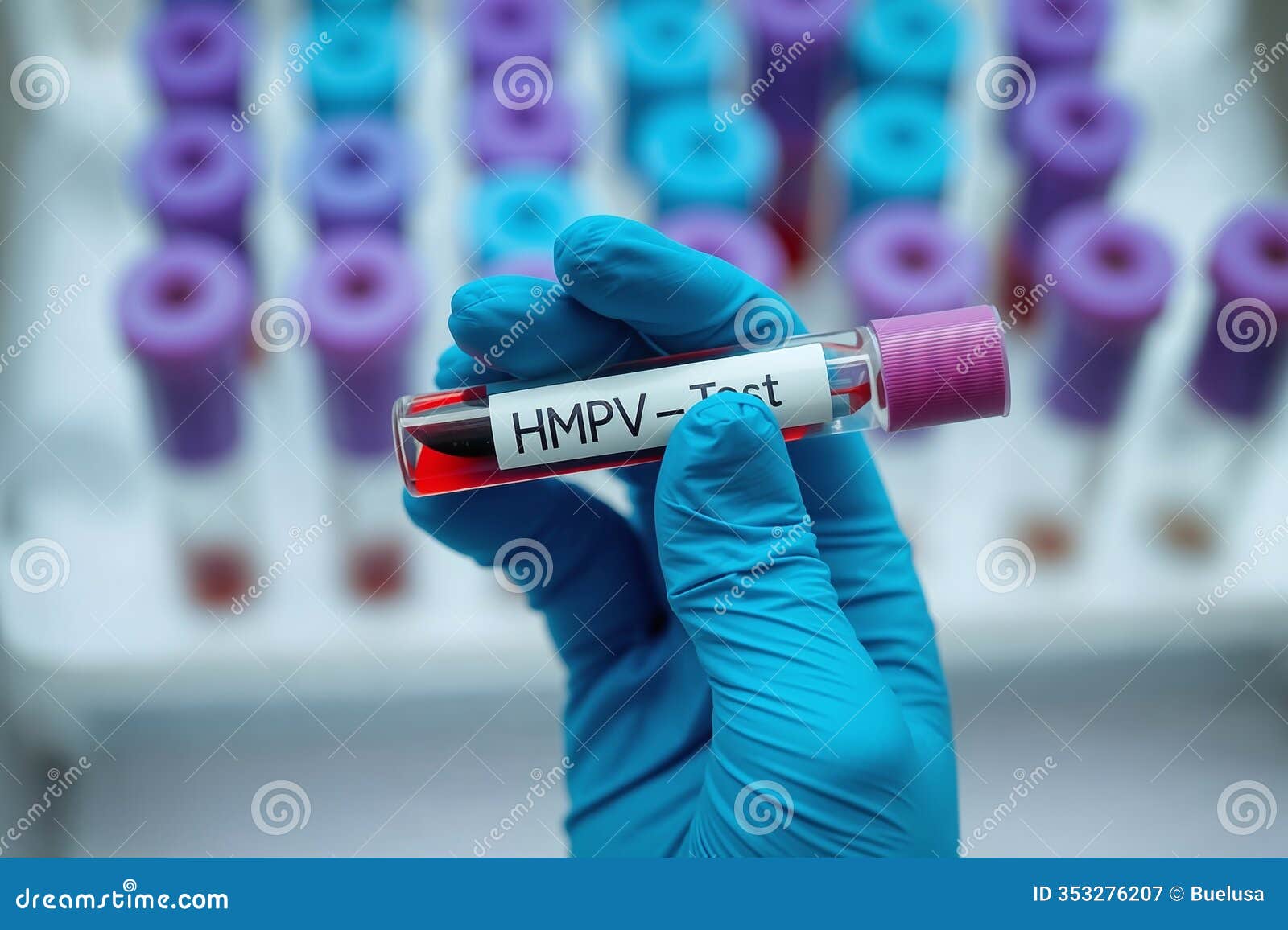 A Gloved Hand Holds a Vial Labeled HMPV Test , Surrounded by Multiple ...
