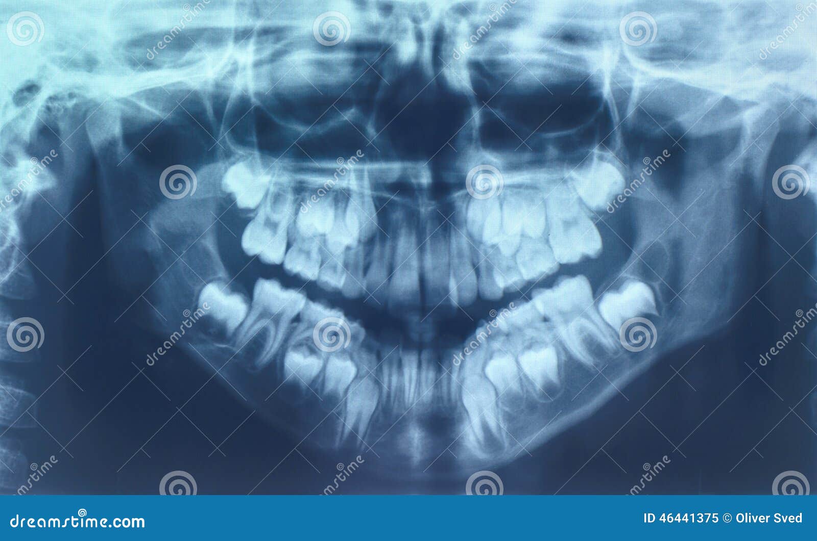 Glowing and Radiant MRI Scan Stock Image - Image of head, concept: 46441375