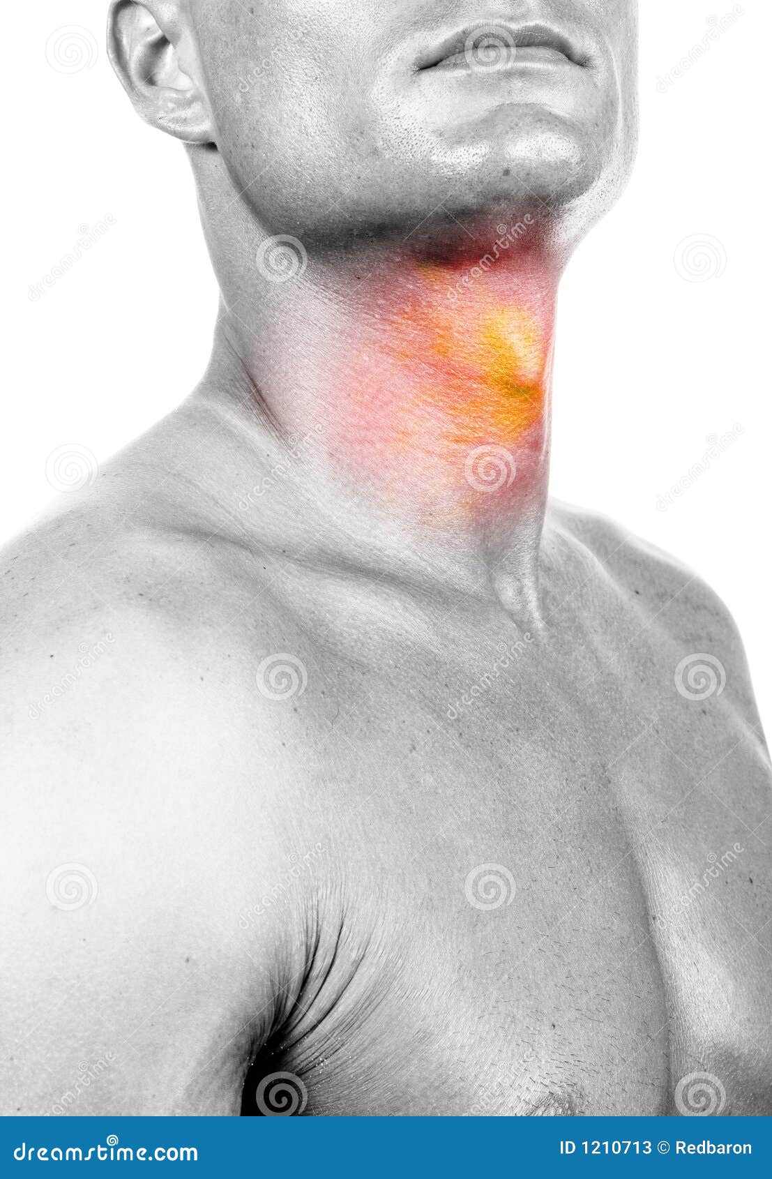 Gola irritata immagine stock. Immagine di ustione, dolore - 1210713