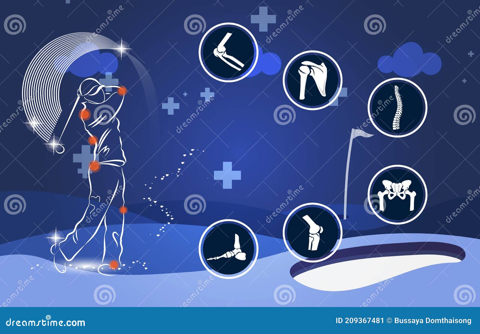 Medical Infographic Orthopedic. Human Silhouette In Golf Motion Injury ...