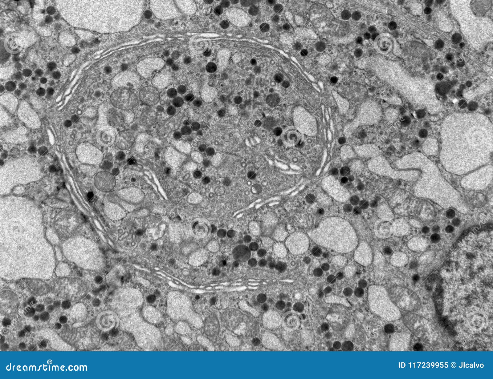 Golgi Apparatus. Gonadotropic Cell. TEM Stock Image - Image of ...