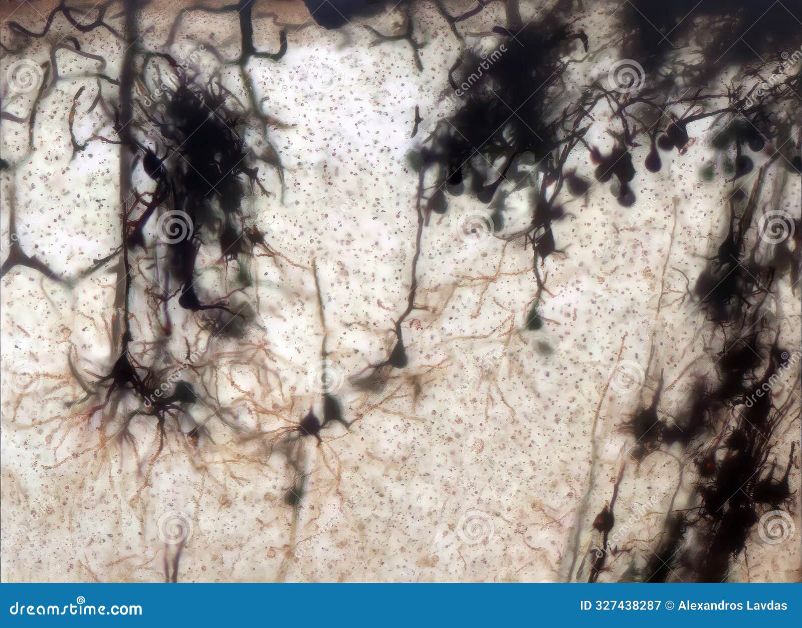 Golgi stain, brain stock image. Image of fragments, neurons - 327438287