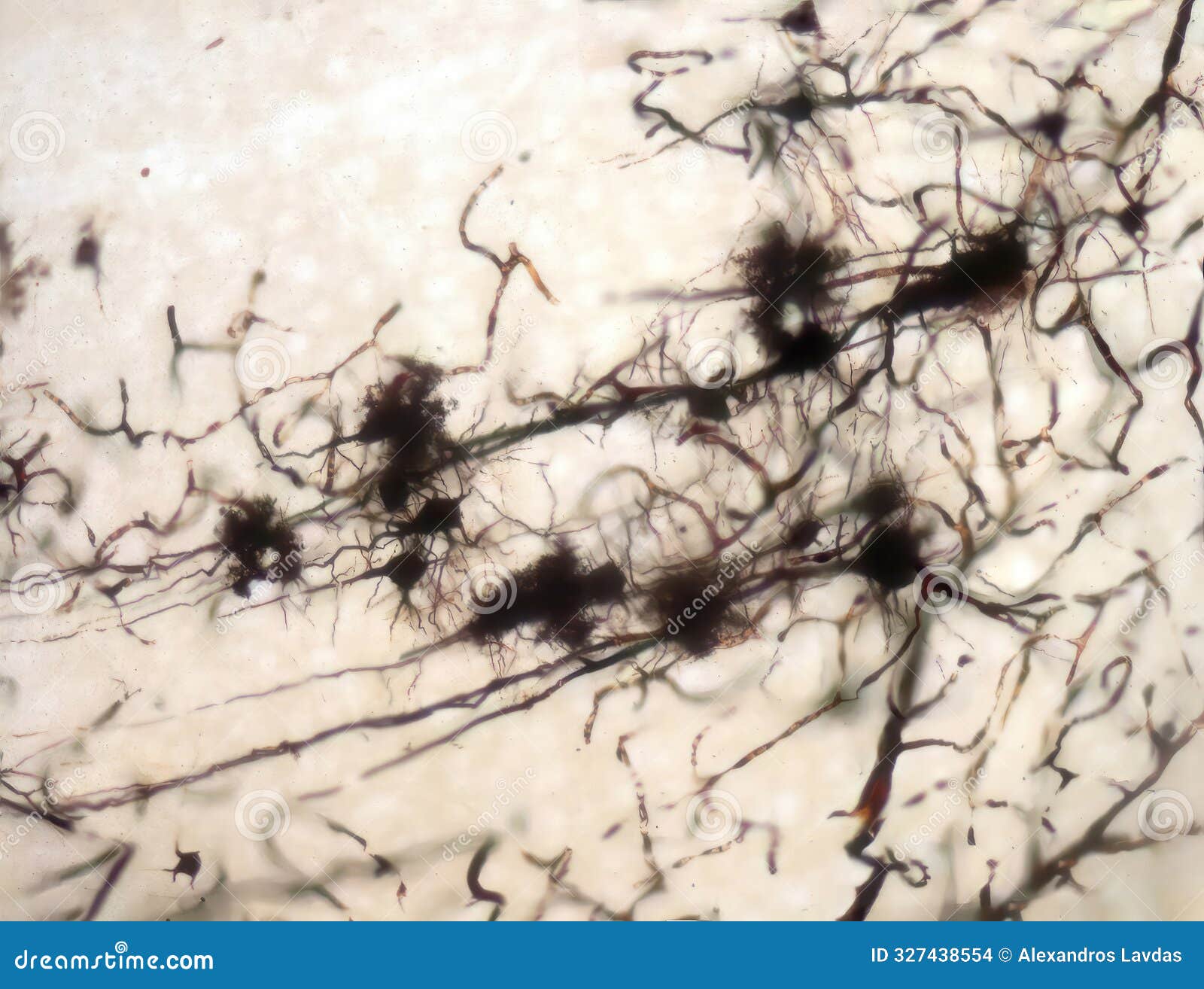 Golgi stain, brain stock photo. Image of brain, golgi - 327438554